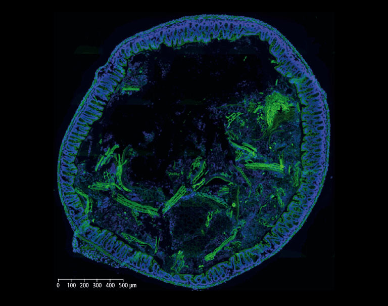 FISHing of gut microbiota – microbiology in health and diseases