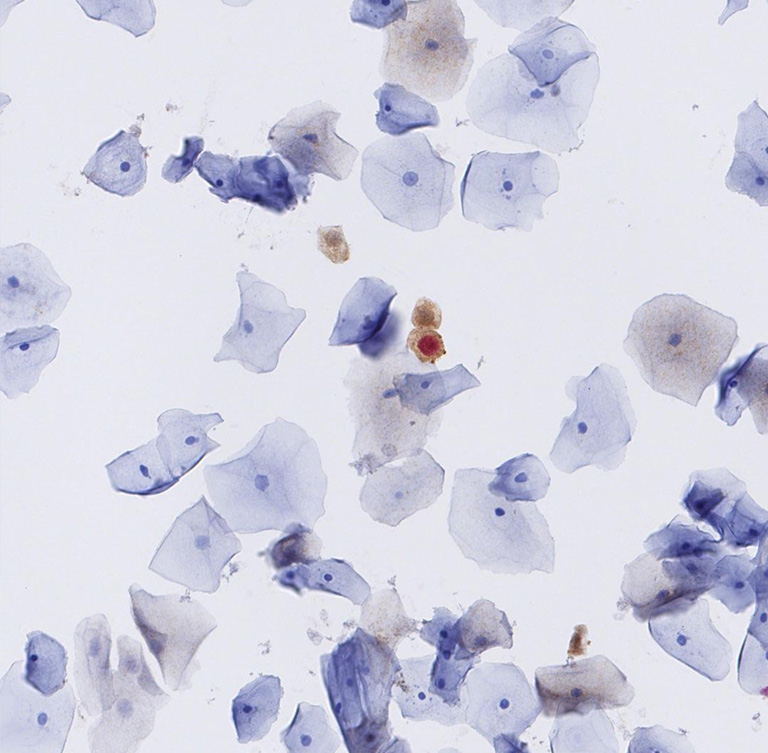 CYTOREADER - a new cloud-based AI dual-stain evaluation platform ...