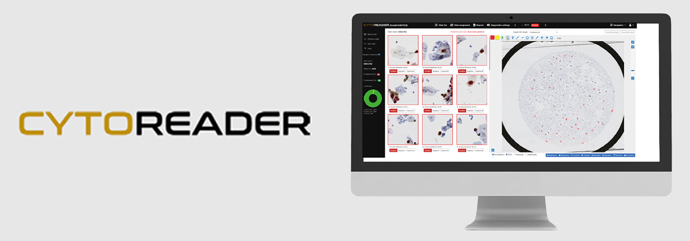 CYTOREADER - a new cloud-based AI dual-stain evaluation platform ...