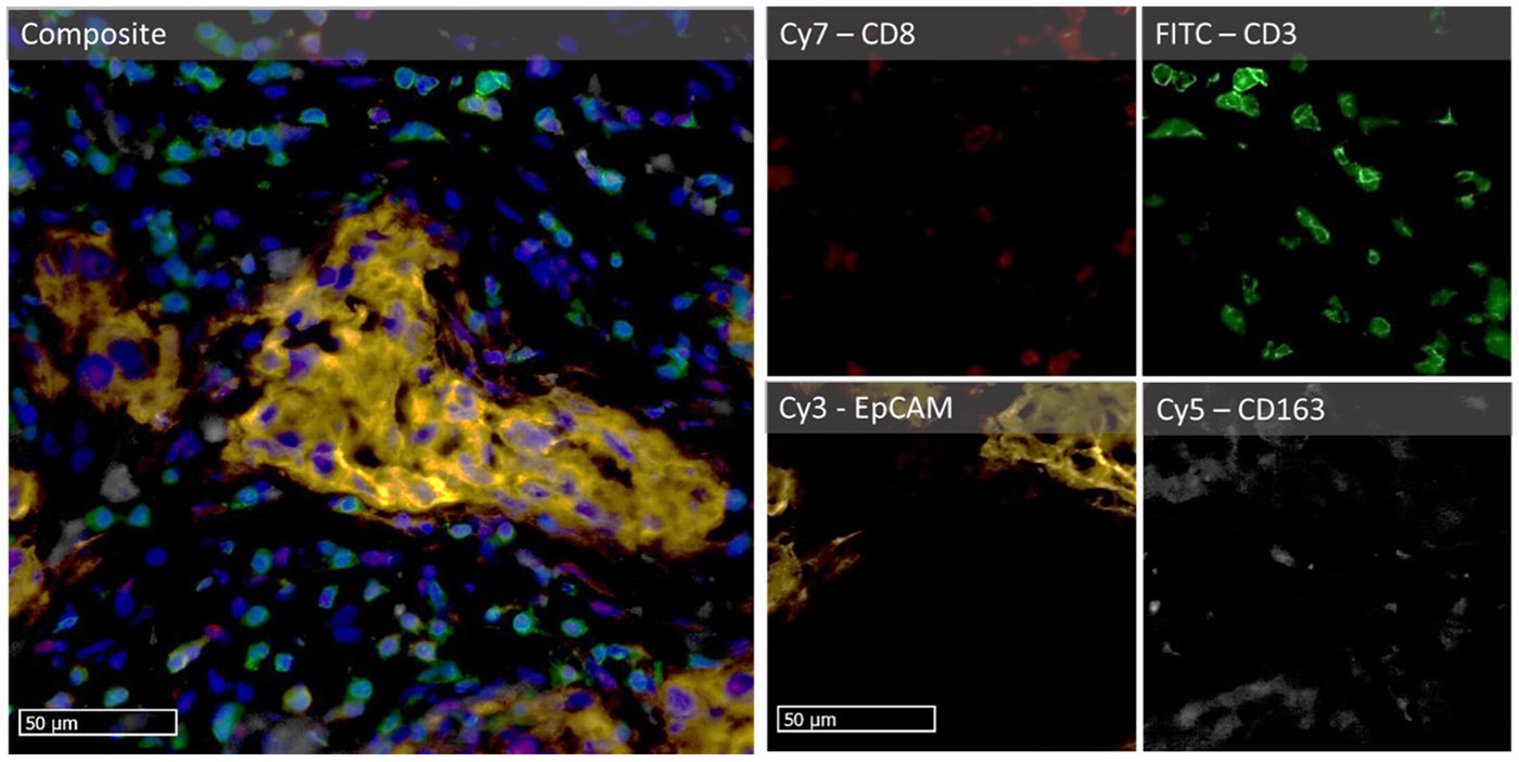 Eagle view multiplex scanning: unveiling cellular interactions in tumor ...