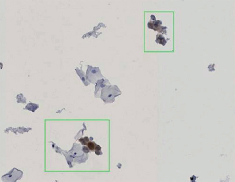 Virtual microscopy system for cervical cytology slides | Hamamatsu ...